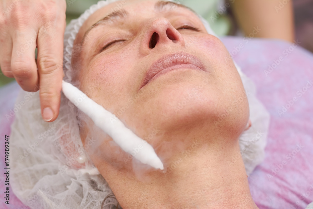 Liquid Nitrogen On Skin