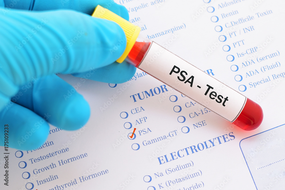 Blood sample with requisition form for PSA test Stock 写真 | Adobe Stock