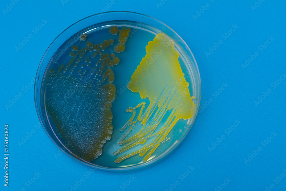 Petri dish with bacteria on blue background. Staphylococcus aureus and ...