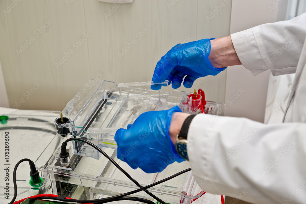 Loading the agarose gel with samples for the separation of DNA ...