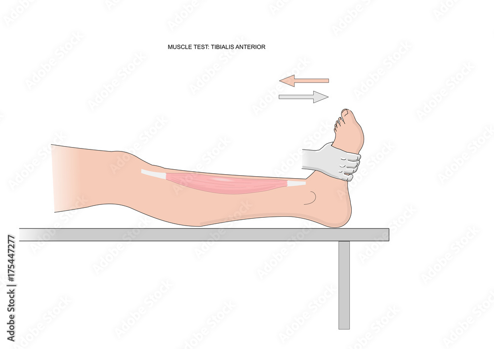 Muscle test of the tibialis anterior, test used in kinesiology ...