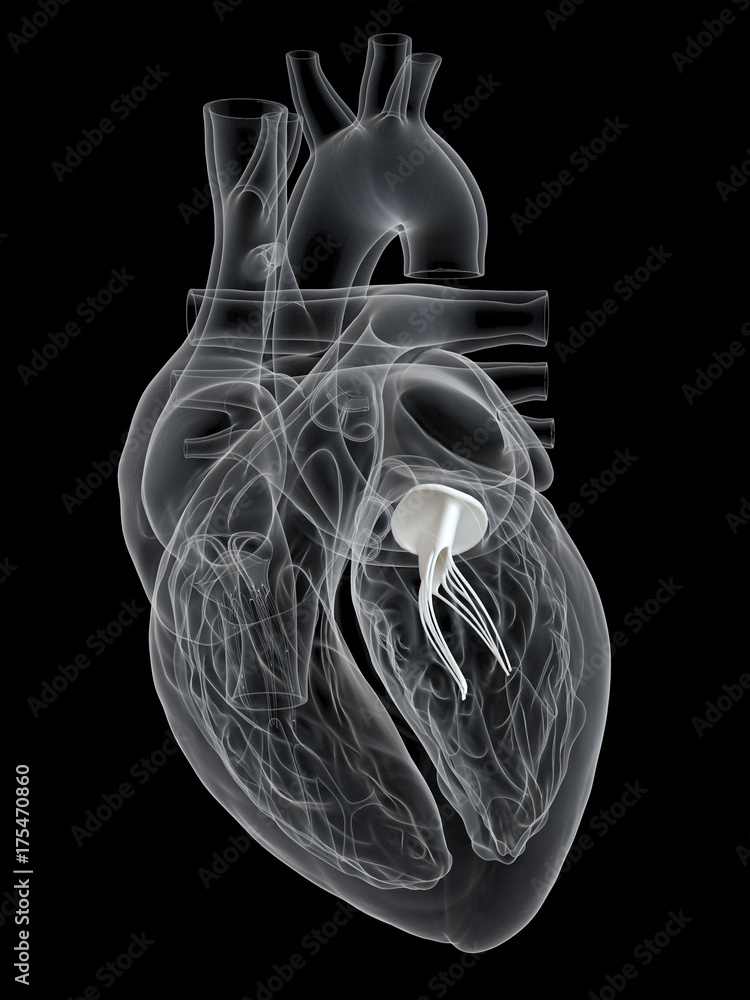 3d rendered medically accurate illustration of the mitral valve Stock ...