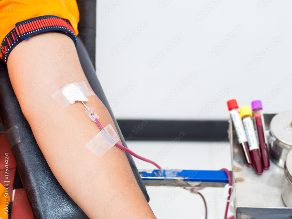 Blood donor at donation, transfusion. Close up right arm of a business ...