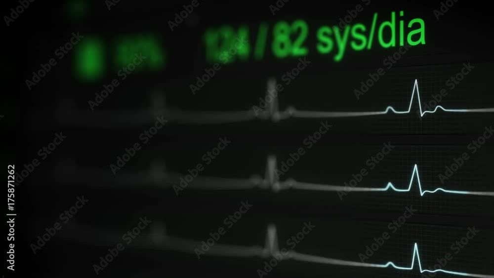 ECG test on monitor. Abstract medical Concept. Computer designed ...