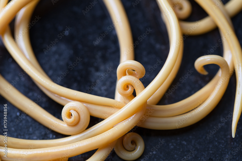 Ascariasis is a disease caused by the parasitic roundworm Ascaris ...