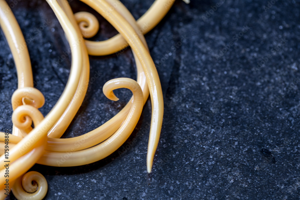 Ascariasis is a disease caused by the parasitic roundworm Ascaris ...