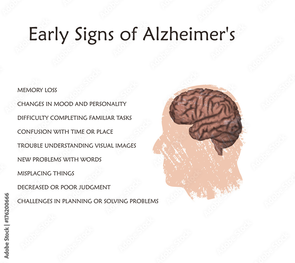Alzheimer's disease early signs poster, banner. Vector medical ...