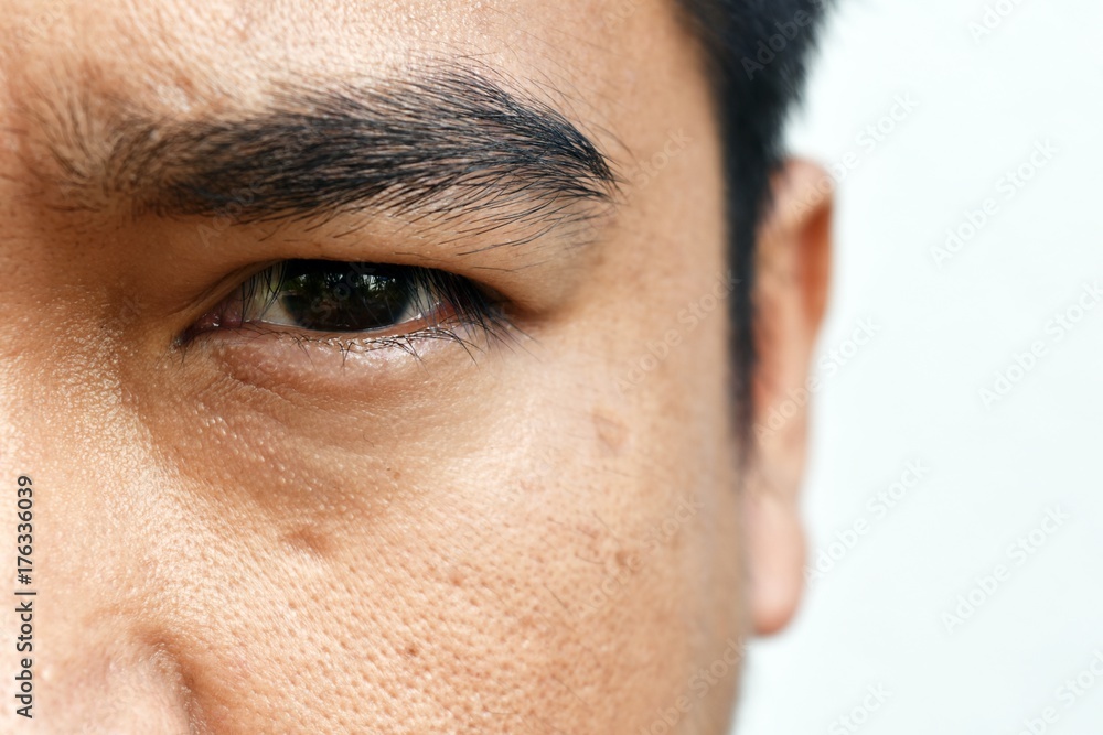 surface young asian man face skin after not get a wink of sleep and do ...