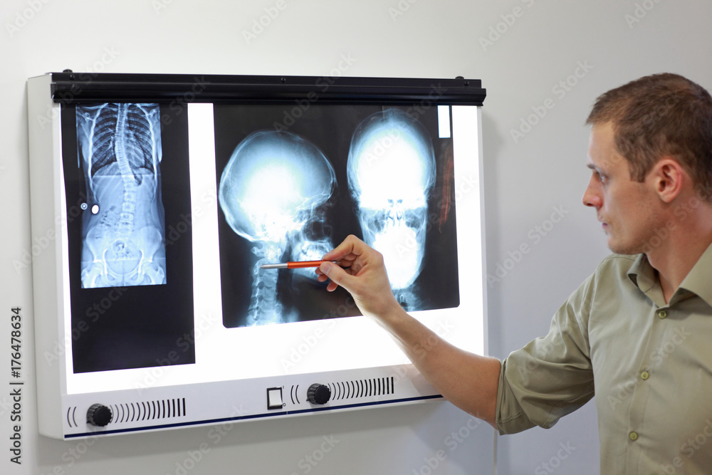 Specialist watching images of skull and spine at x-ray film viewer ...