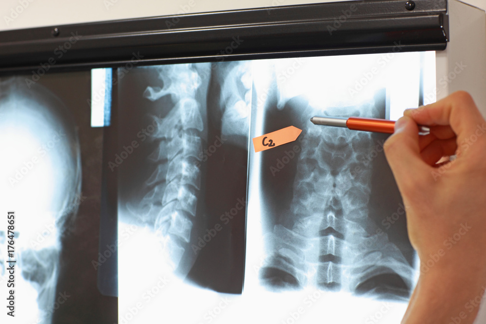 Foto de Hand with pointer working with images of spine and skull at x ...