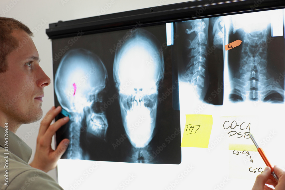 Case study. Specialist making notes,watching images of skull and spine ...
