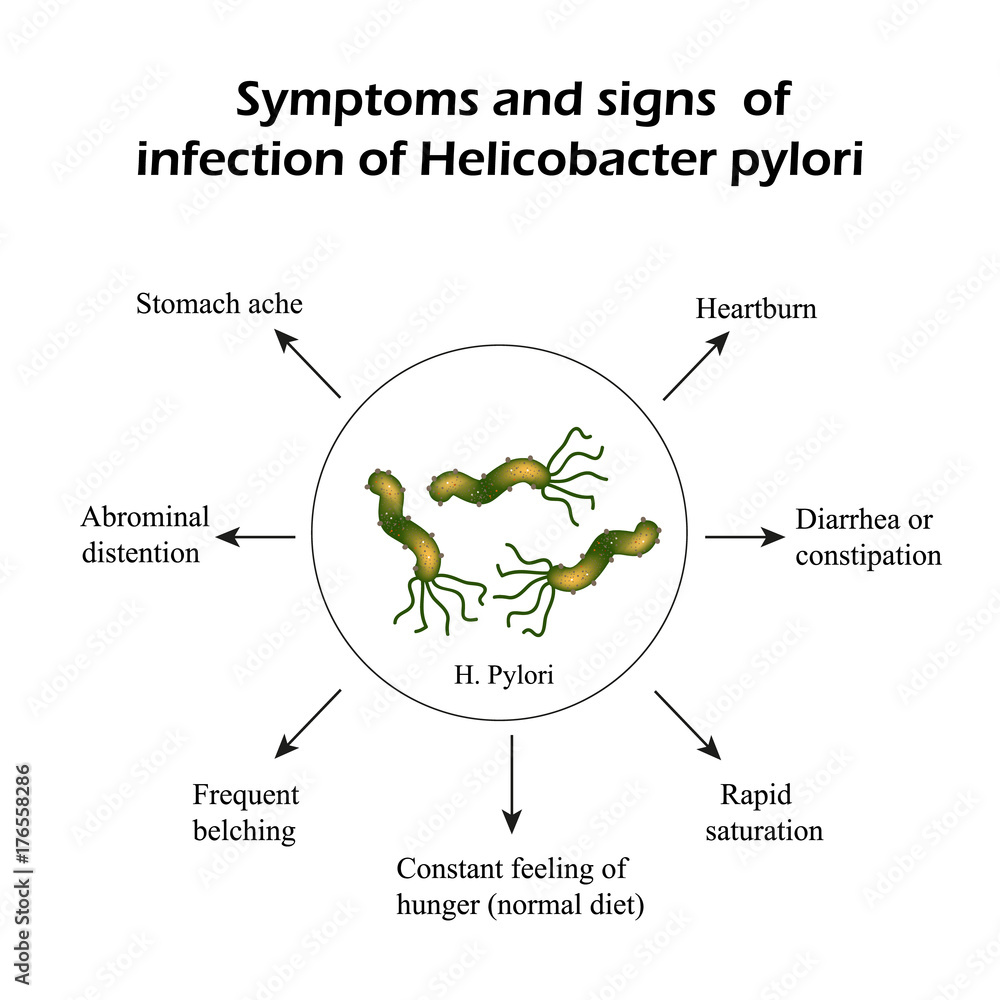 Helicobacter pylori. Symptoms of infection. Infographics. Vector ...