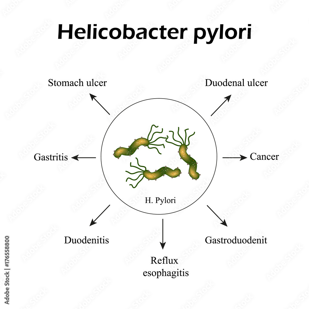 Helicobacter Pylori Diseases Caused By Helicobacter Pylori