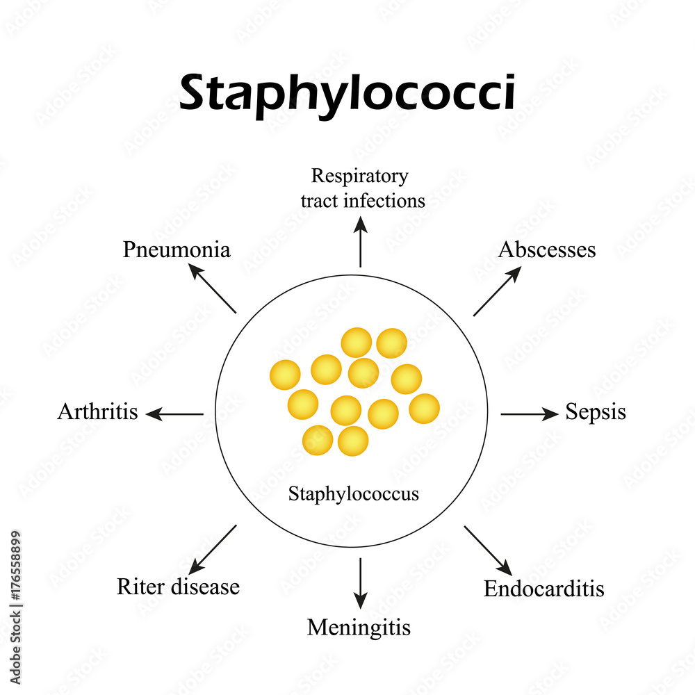 Staphylococcus Aureus Diagram