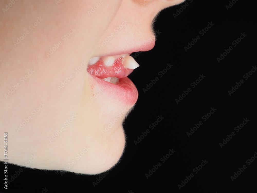 Side of little girl loosing a primary tooth at closeup towards black ...