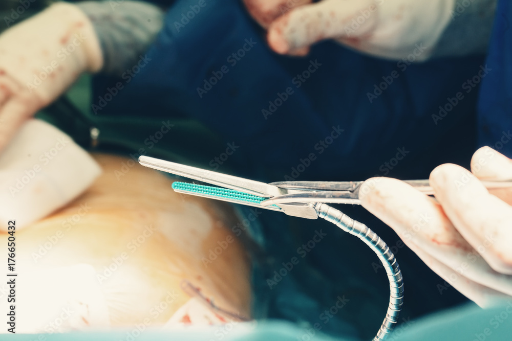 cannula and aorta is cross clamping using special flexible aorta clamp ...