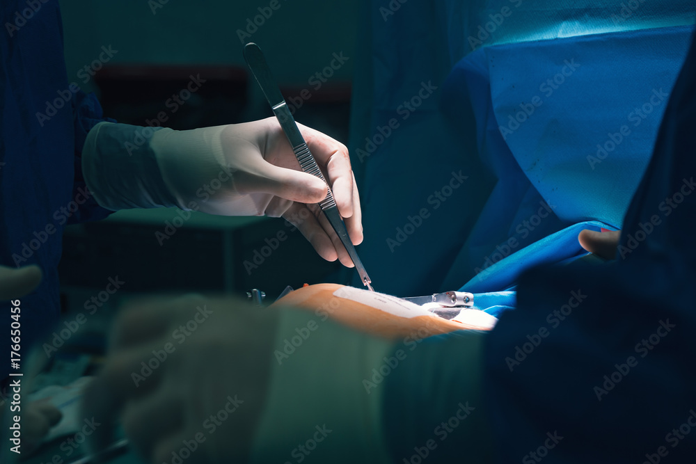 Team of surgeons using electric cautery and clamps for minithoracotomy ...