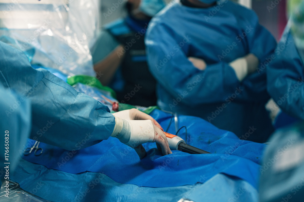 Interventional cardiologist surgeon do AAA endovascular treatment stent ...