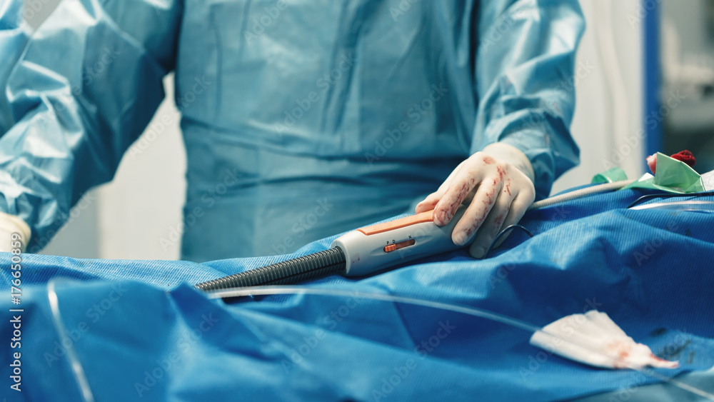 Interventional cardiologist surgeon do AAA endovascular treatment stent ...