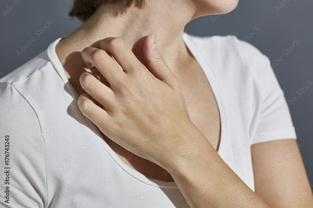 Mädchen juckt sich Stock Photo | Adobe Stock