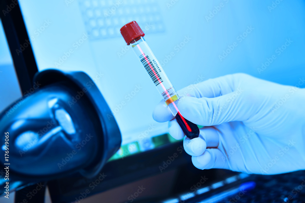 scanning bar code of test tubes in a bacteriological laboratory Stock ...