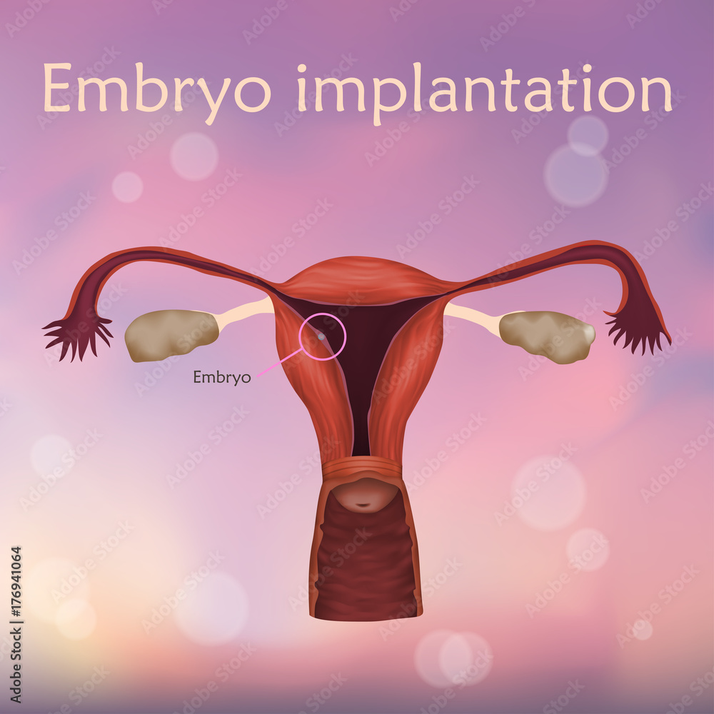 Embryo Implantation The Fertilized Egg Uterus Womb Anatomy Illustration Blurred Pink