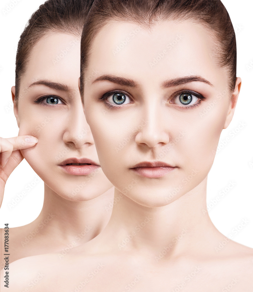 Young woman pulling her elasticity skin Stock Photo | Adobe Stock