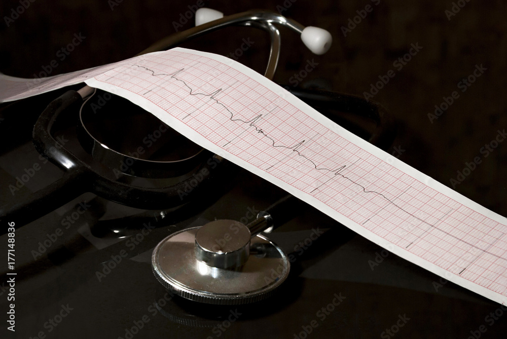 Death electrocardiogram. Cardiac arrest. ECG on the black glass ...