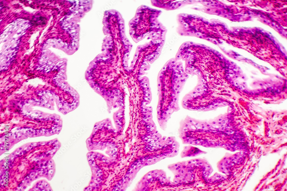 Transitional epithelium tissue of the urinary bladder under microscope ...