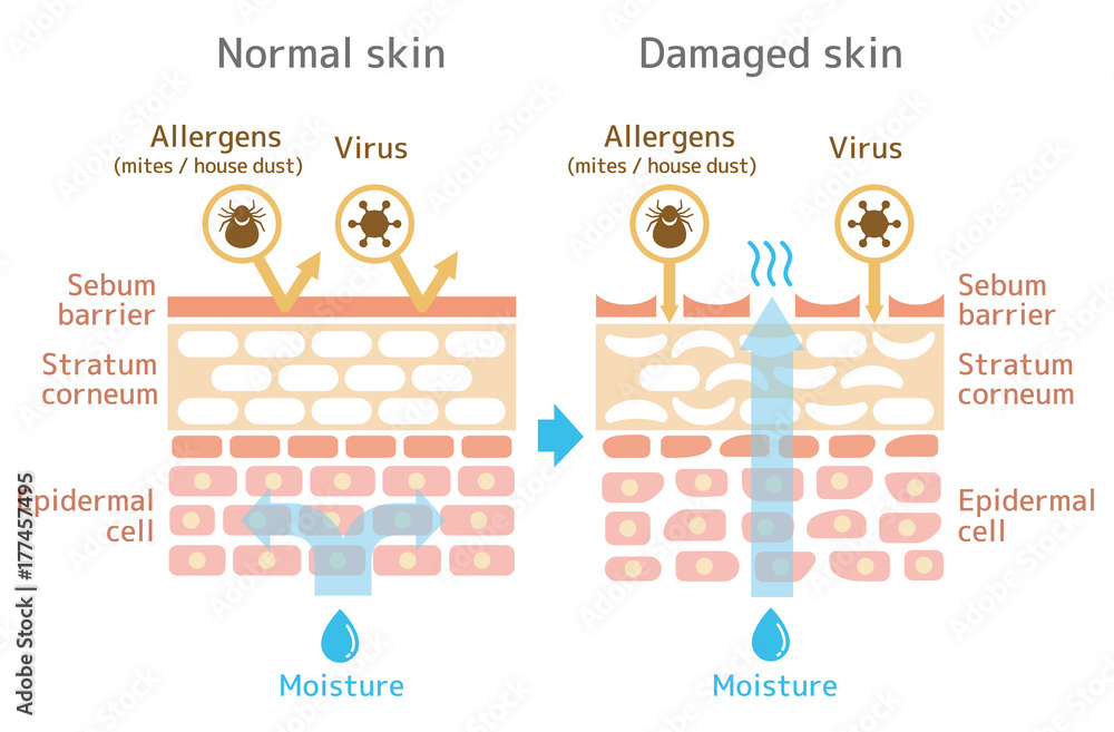 Sectional view of the skin.Comparison illustration of protection effect ...