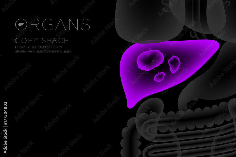 Human Organs X-ray set, Liver infection concept idea purple color ...
