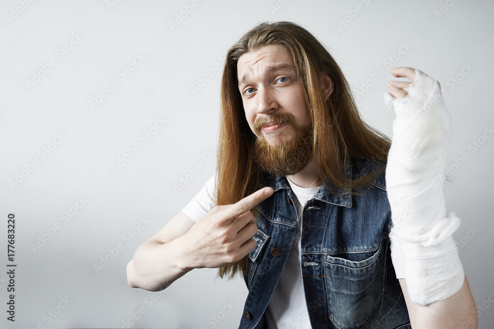 Upset bearded man posing at studio wall background with broken arm in ...