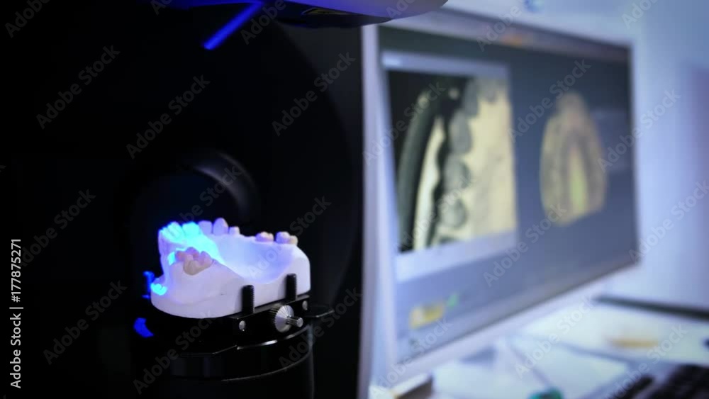 Dental prosthetic restoration. Denturist is making 3D model for ...