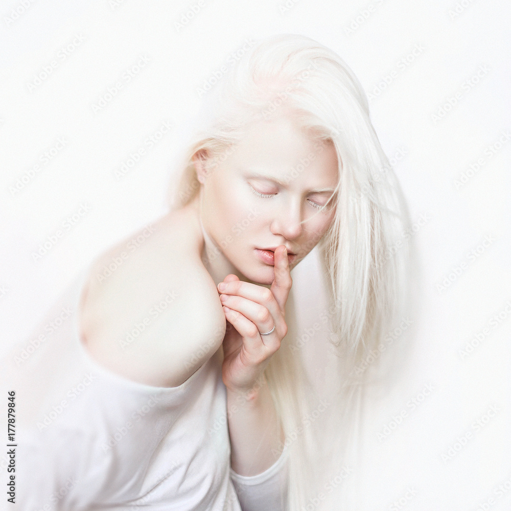 Albino girl with white skin, natural lips and white hair. Photo face on ...