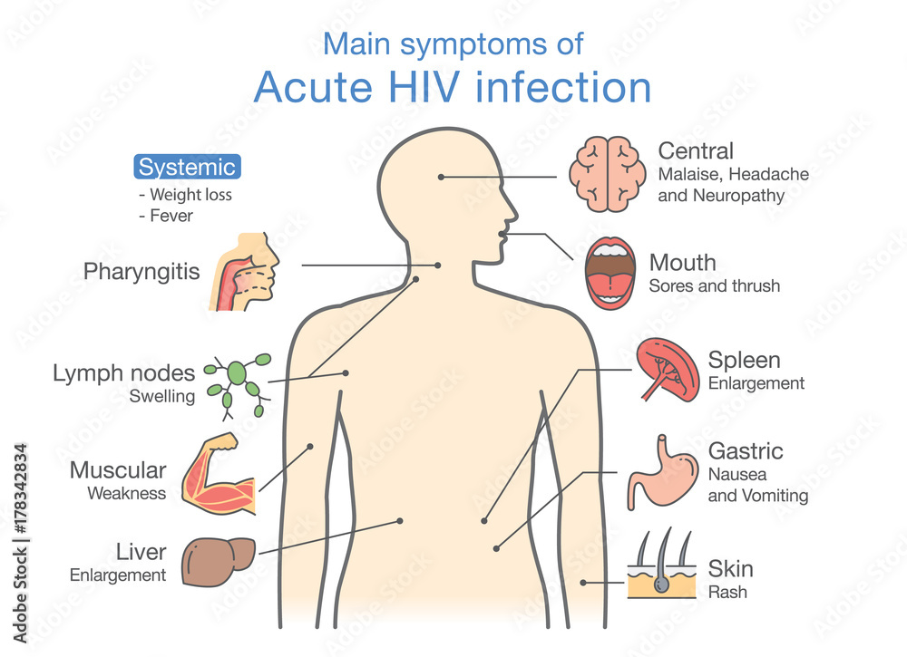 Main Symptom Of Acute Hiv Infection Illustration About Diagram For