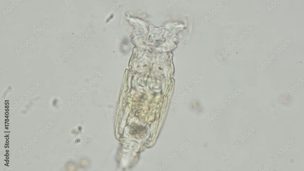 Rotifers are microscopic aquatic animals of the phylum Rotifera ...