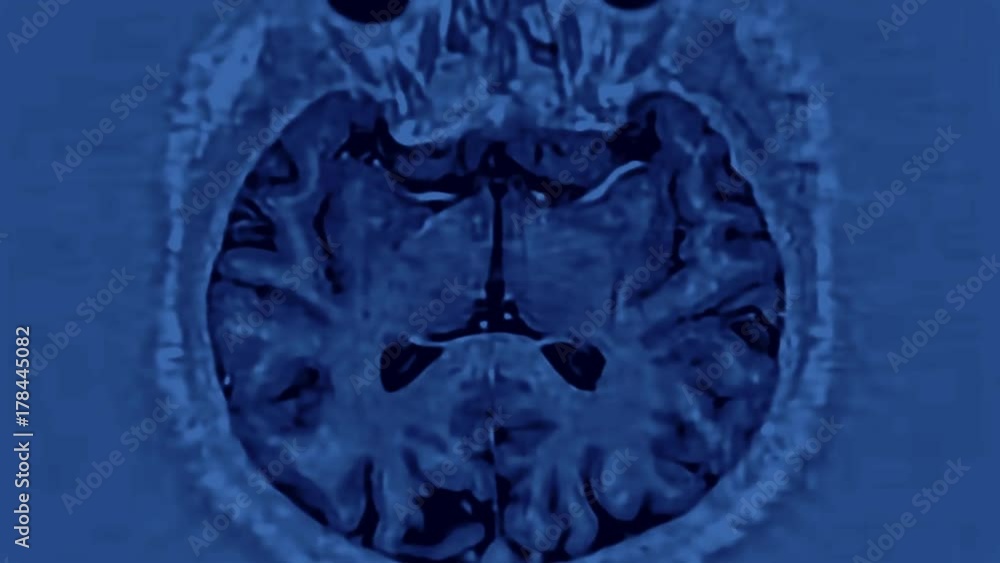 MRI brain scan,magnetic resonance imaging of a brain, ultra hd 4k, time ...