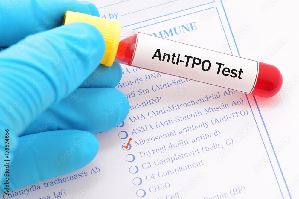 Blood sample with requisition form for anti-TPO test, autoimmune ...