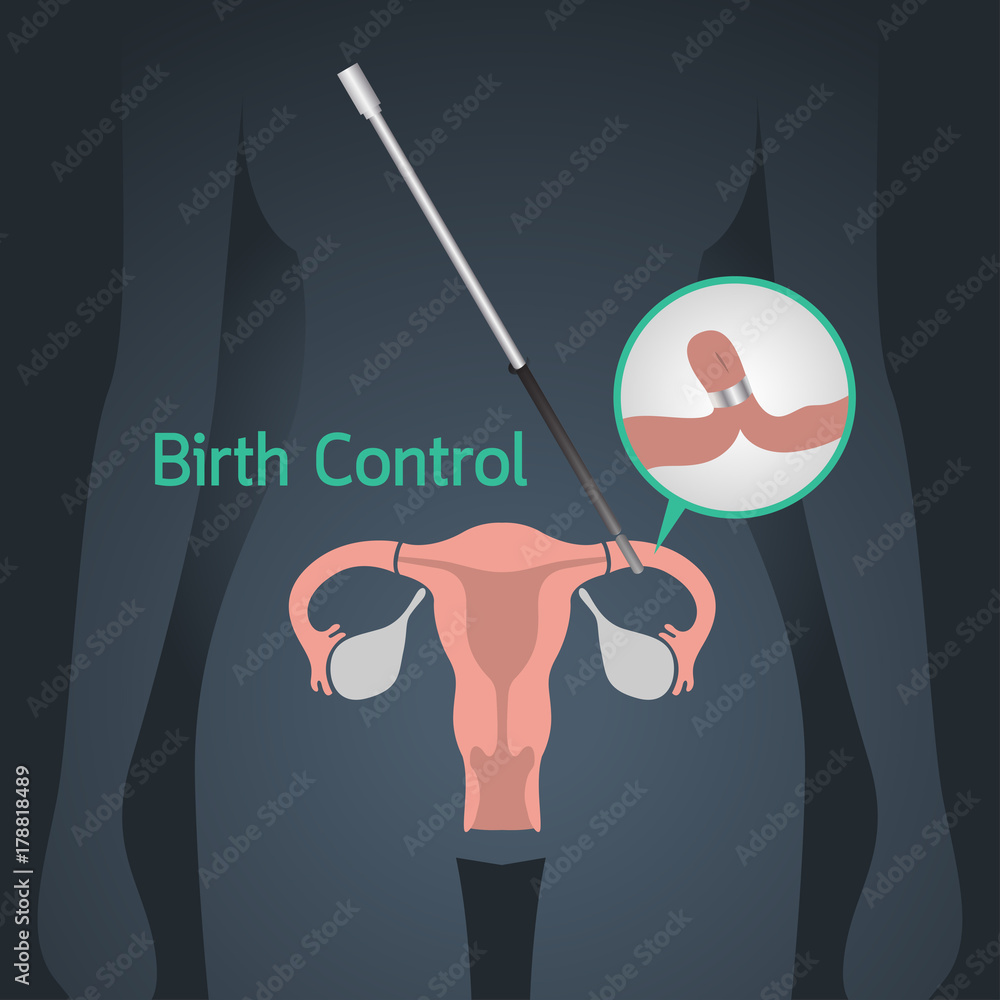 Birth Control vector logo icon illustration Stock Vector | Adobe Stock