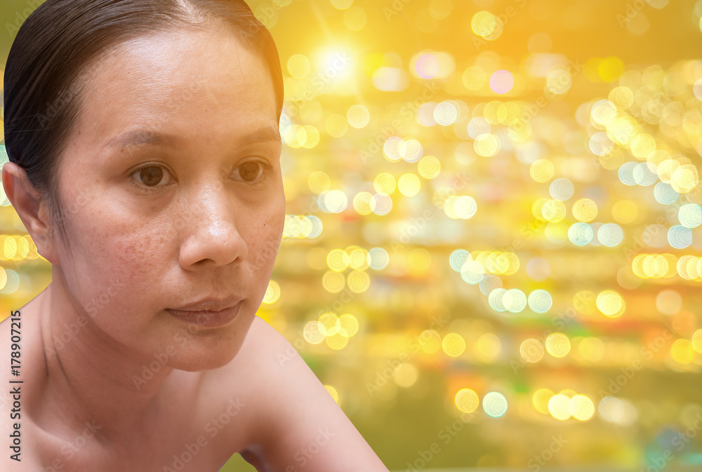 Women problems of face skin, aged turn to flaky and dark spot issues ...