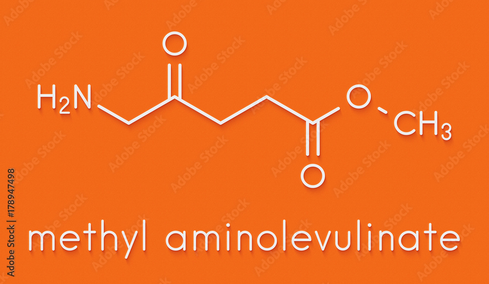 Methyl aminolevulinate non-melanoma skin cancer drug molecule. Used in ...
