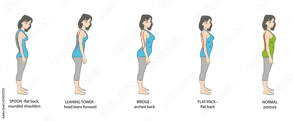 types of posture women. vector illustration. Stock Vector | Adobe Stock
