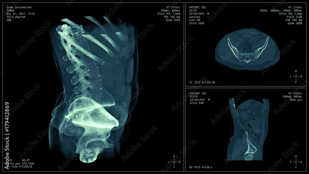 Body CT scan image, radiography x-ray examination, MRI tomography ...