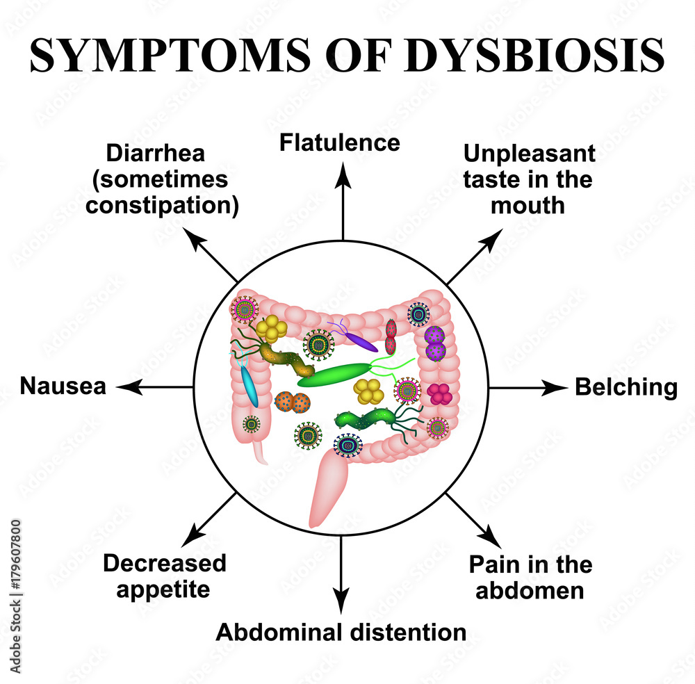 Symptoms of dysbiosis. Dysbacteriosis of the intestine. The large ...