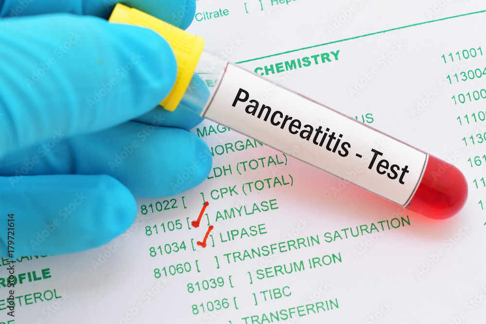Poster Blood sample with requisition form for pancreatitis test ...