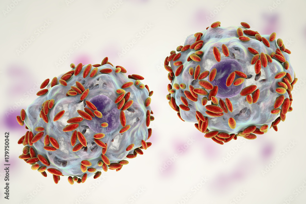 Microscopic diagnosis of bacterial vaginosis. Vaginal secretions ...