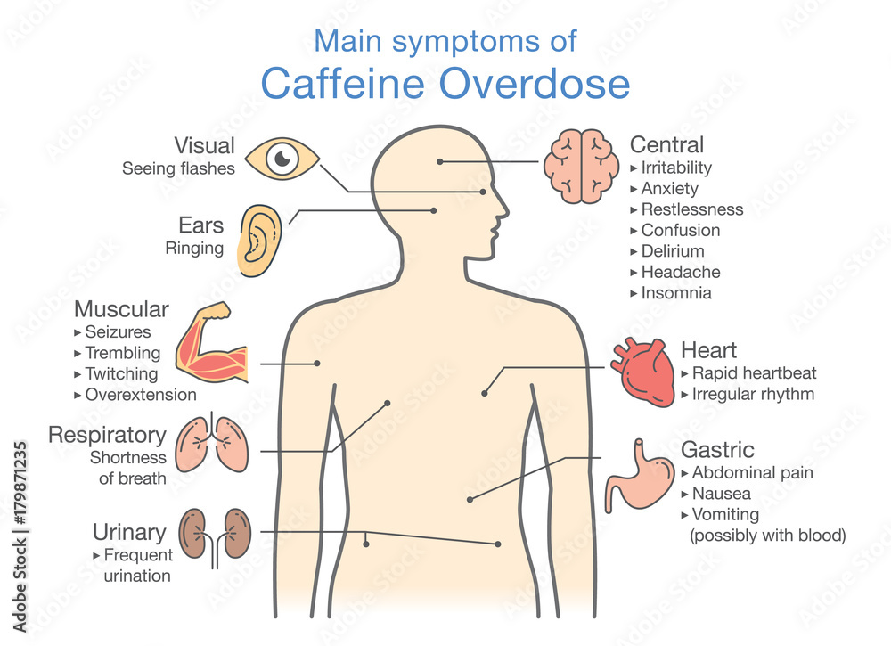 Main symptoms of Caffeine Overdose. Illustration about health check up ...