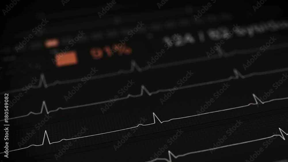 ECG waves on medical monitor. Healthcare concept. Computer generated ...