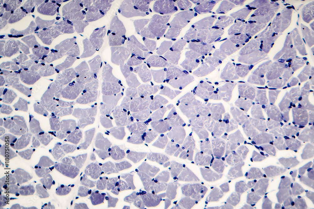 Human skeletal muscle, cross section, light micrograph Stock Photo ...