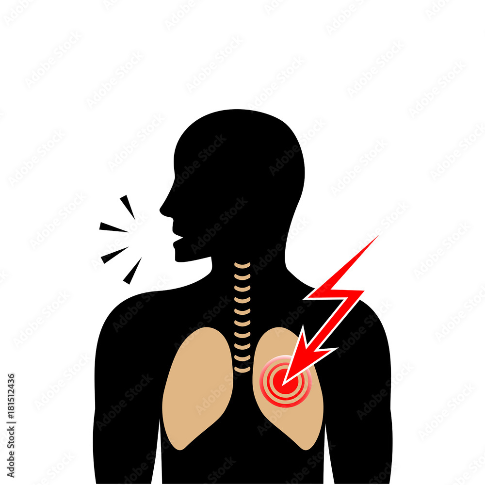 Silhouette of coughing man. Pain in lungs. Vector illustration. Stock ...